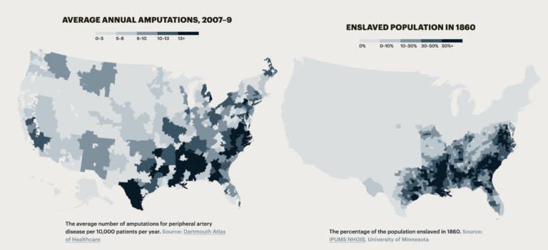 The Black American Amputation Epidemic - Hyroglf